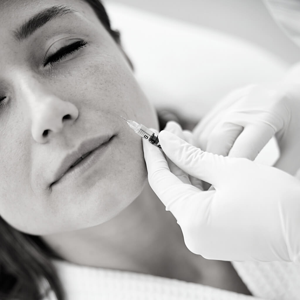 ¿Cómo actúa el ácido hialurónico en el surco nasogeniano?