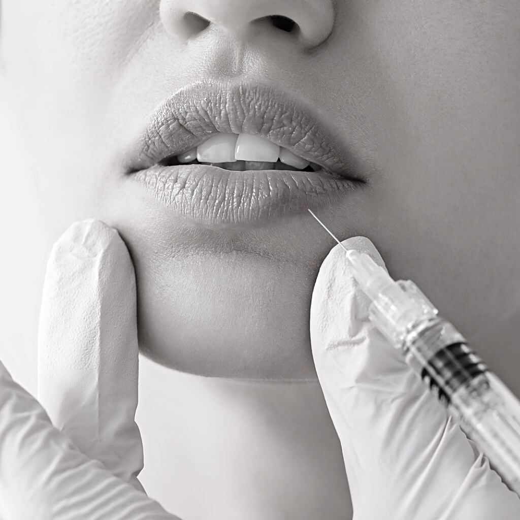 Relleno de labios. Opciones y mejores soluciones